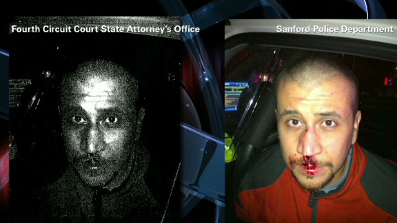 George Zimmerman Sues Nbc Universal Over Edited 911 Call Cnn