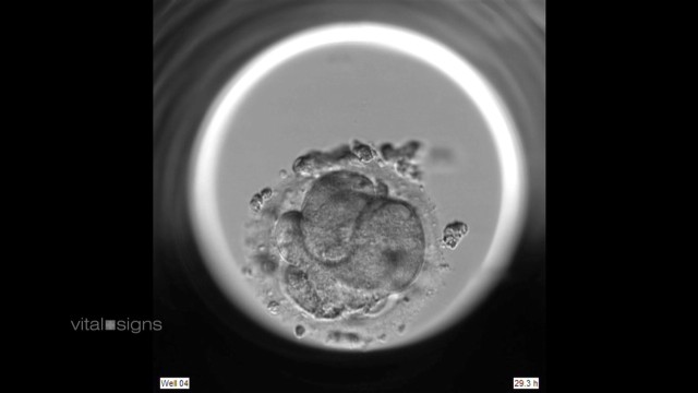 How does IVF work? - CNN Video How does IVF work? - CNN Video