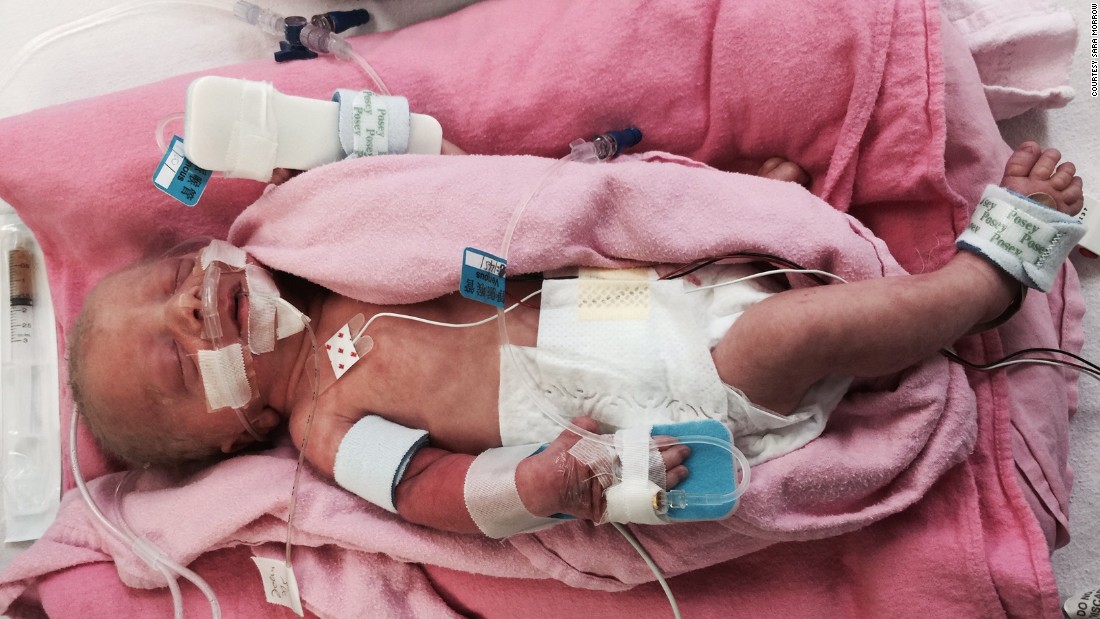 U S Mom Gives Birth In Transit Gets Stranded Cnn