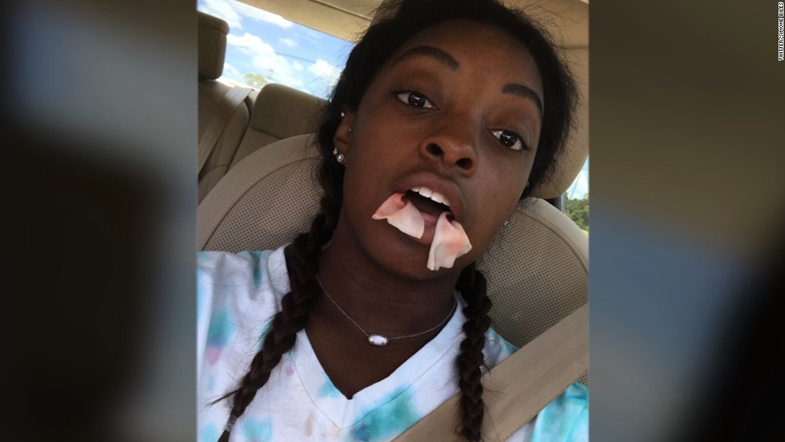 Simone Biles tweets dazed post-surgery video - CNN Video