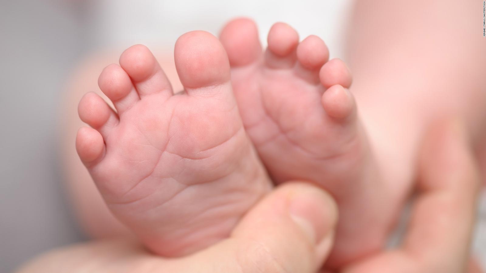 France launches investigation after babies born without limbs - CNN France launches investigation after babies born without limbs - CNN