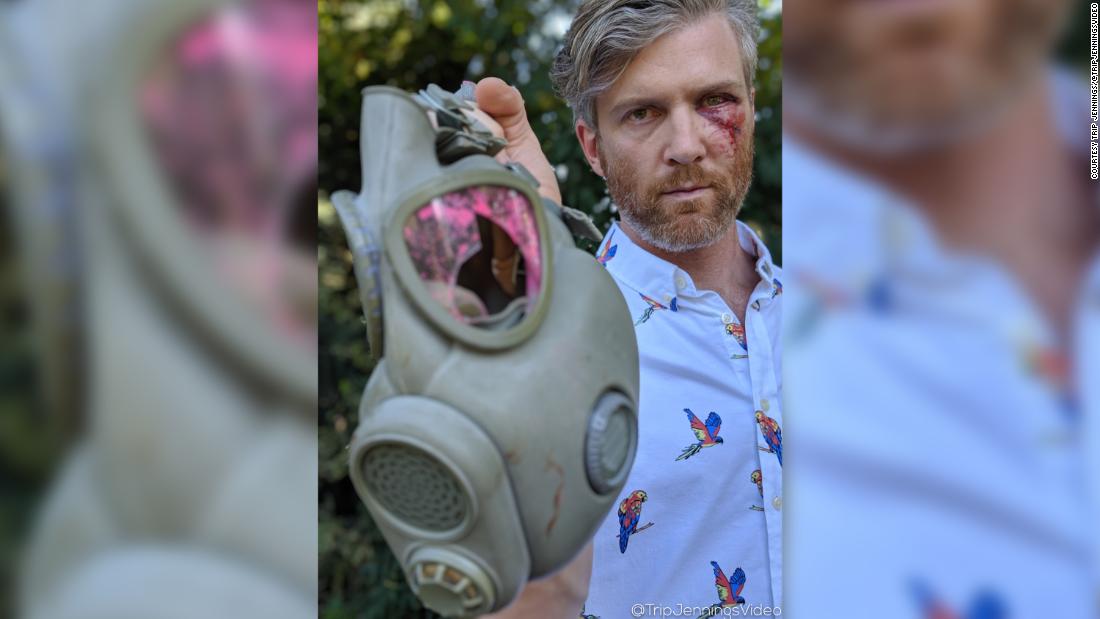 Portland Protests Photojournalist Shot In The Eye Says Its Not Just